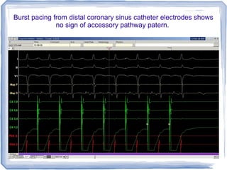 Accessories Pathway/WPW | ODP
