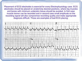 Accessories Pathway/WPW | ODP