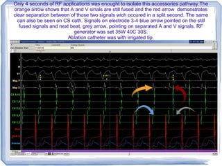 Accessories Pathway/WPW | ODP