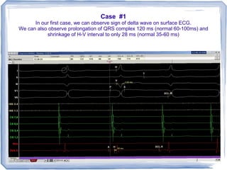 Accessories Pathway/WPW | ODP