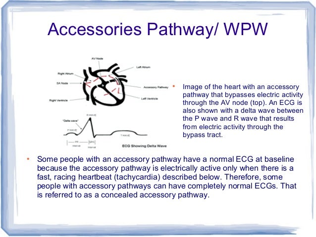 Accessories Pathway/WPW