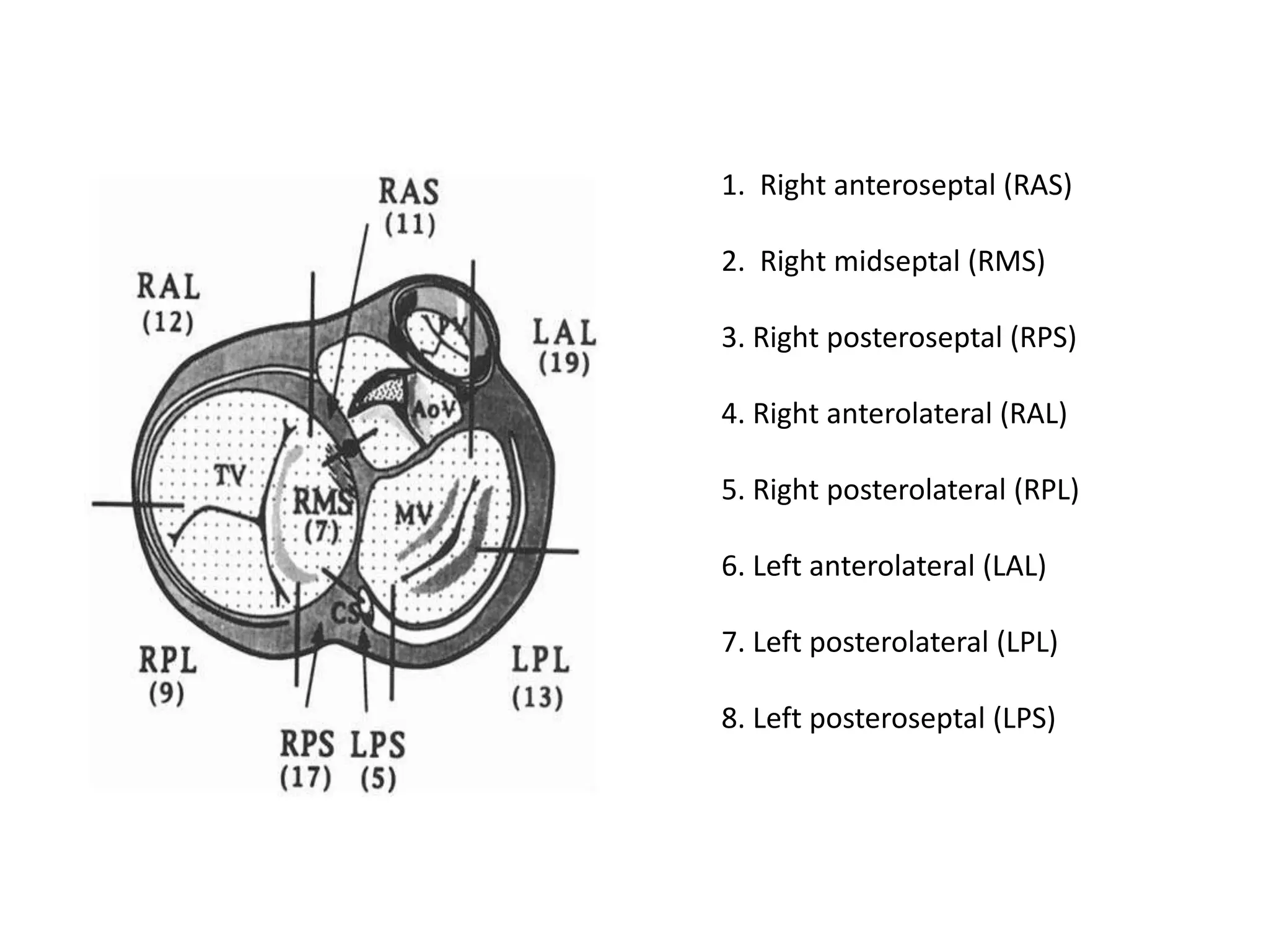 Localization of WPW( accessory Pathway) by surface ECG | PPTX