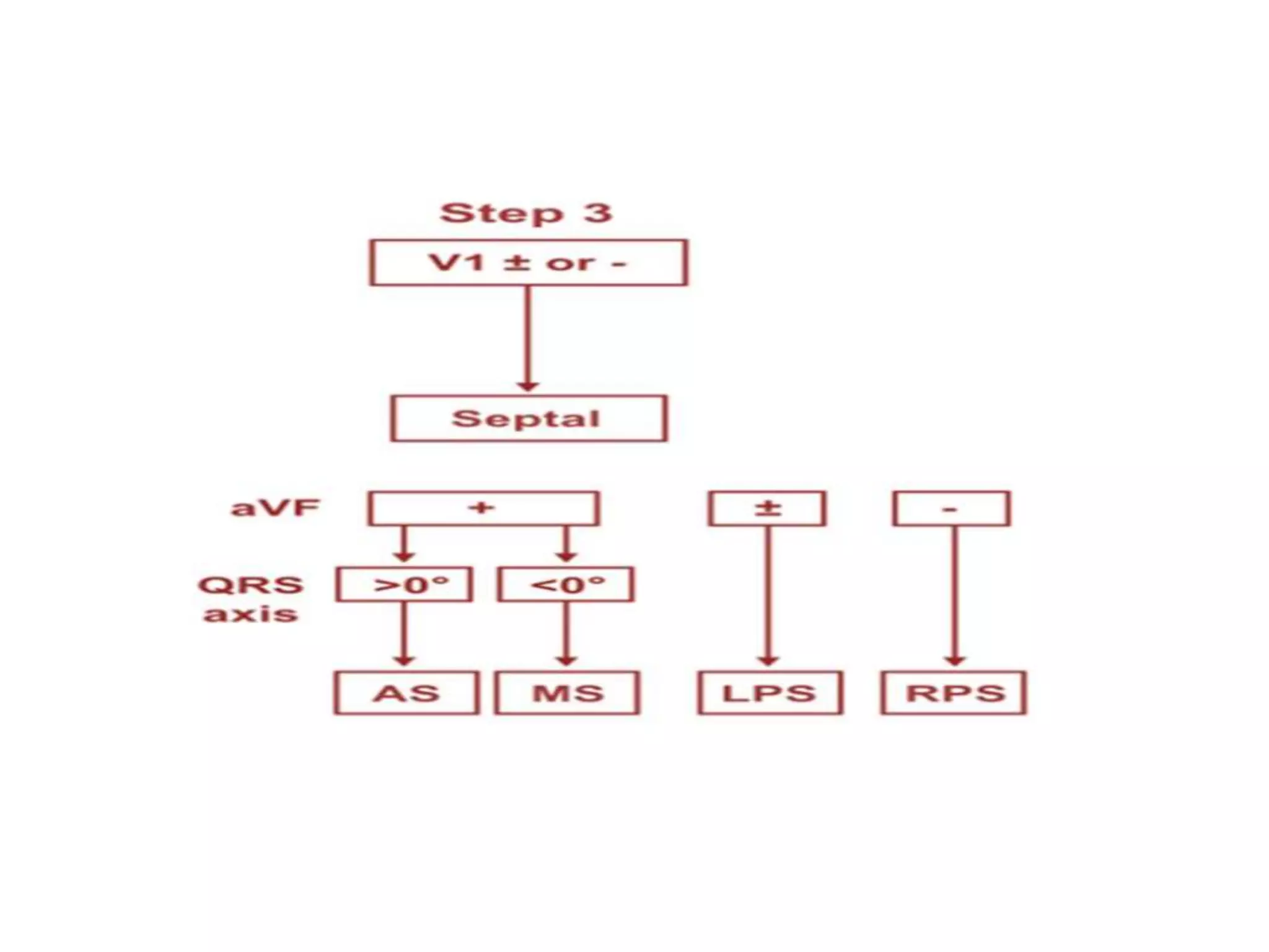 Localization of WPW( accessory Pathway) by surface ECG | PPTX | Heart ...