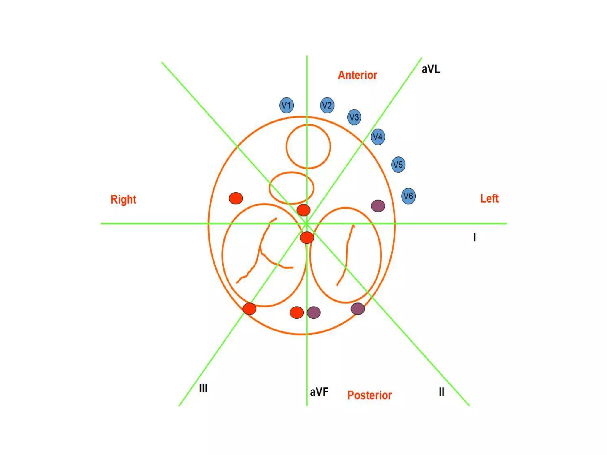 Localization of WPW( accessory Pathway) by surface ECG | PPTX