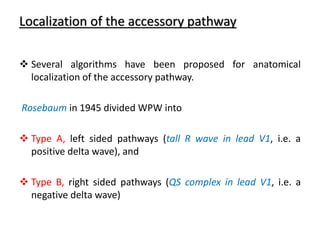 Localization of WPW( accessory Pathway) by surface ECG | PPTX