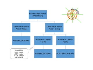 Localization of WPW( accessory Pathway) by surface ECG | PPTX