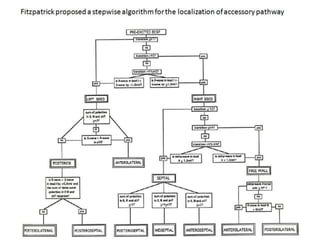 Localization of WPW( accessory Pathway) by surface ECG | PPTX