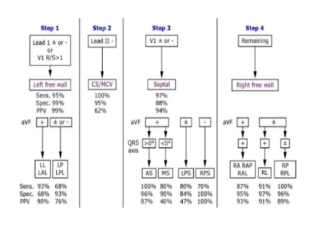 Localization of WPW( accessory Pathway) by surface ECG