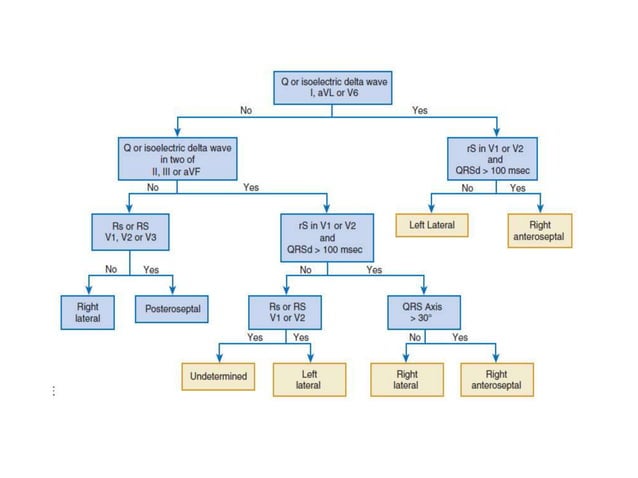 Localization of WPW( accessory Pathway) by surface ECG | PPT
