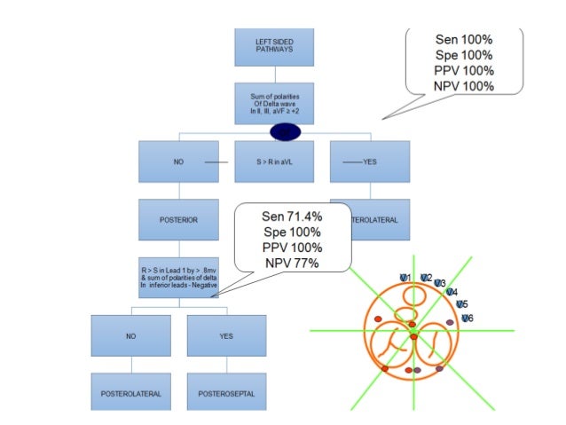 Localization of WPW( accessory Pathway) by surface ECG