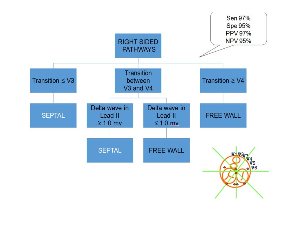 Localization of WPW( accessory Pathway) by surface ECG