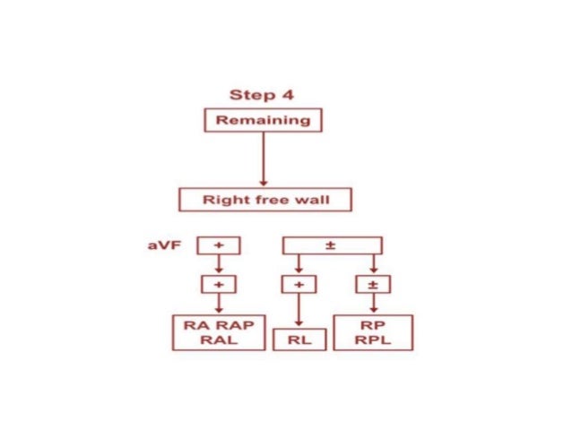 Localization of WPW( accessory Pathway) by surface ECG