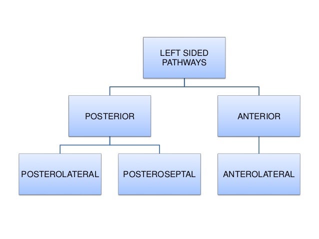 Localization of WPW( accessory Pathway) by surface ECG
