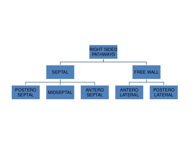 Localization of WPW( accessory Pathway) by surface ECG
