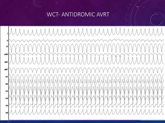 wpwepevaluation-,,,,,,,,,,,211107143718.pptx