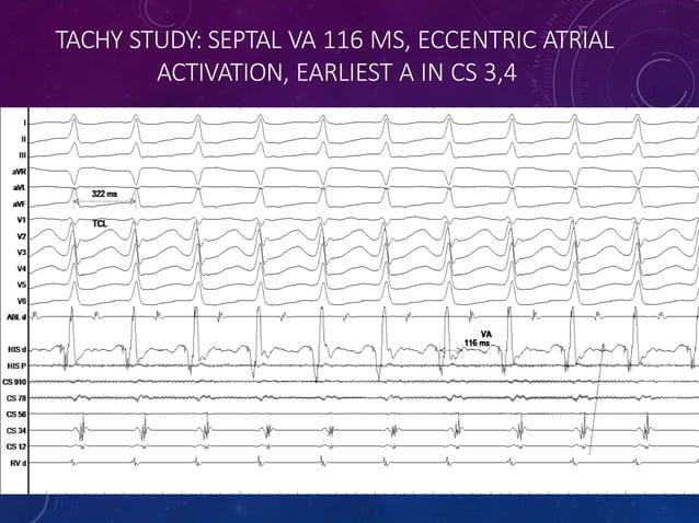 wpwepevaluation-,,,,,,,,,,,211107143718.pptx