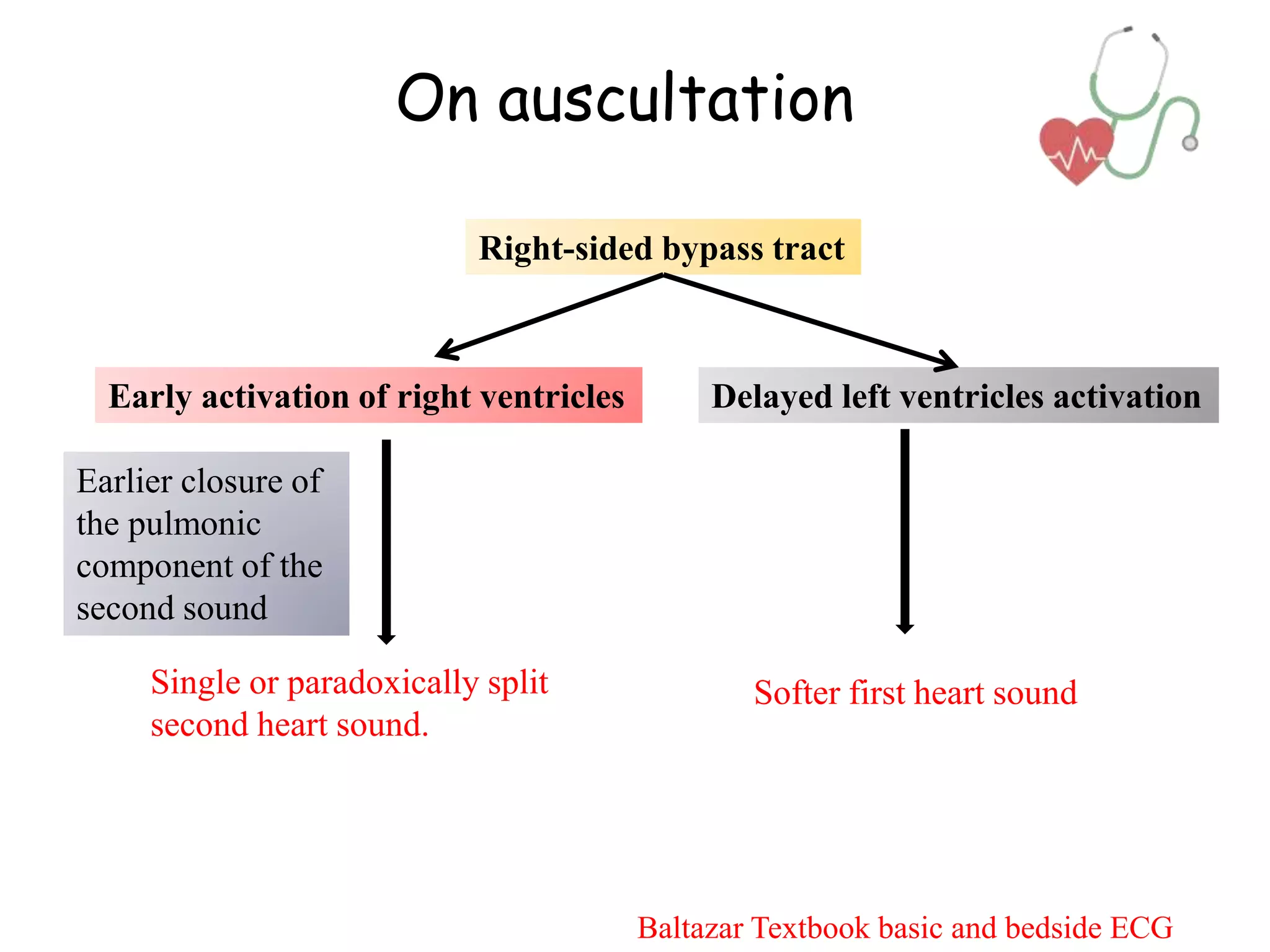 ECG localization of accessory pathways slideshare | PPTX