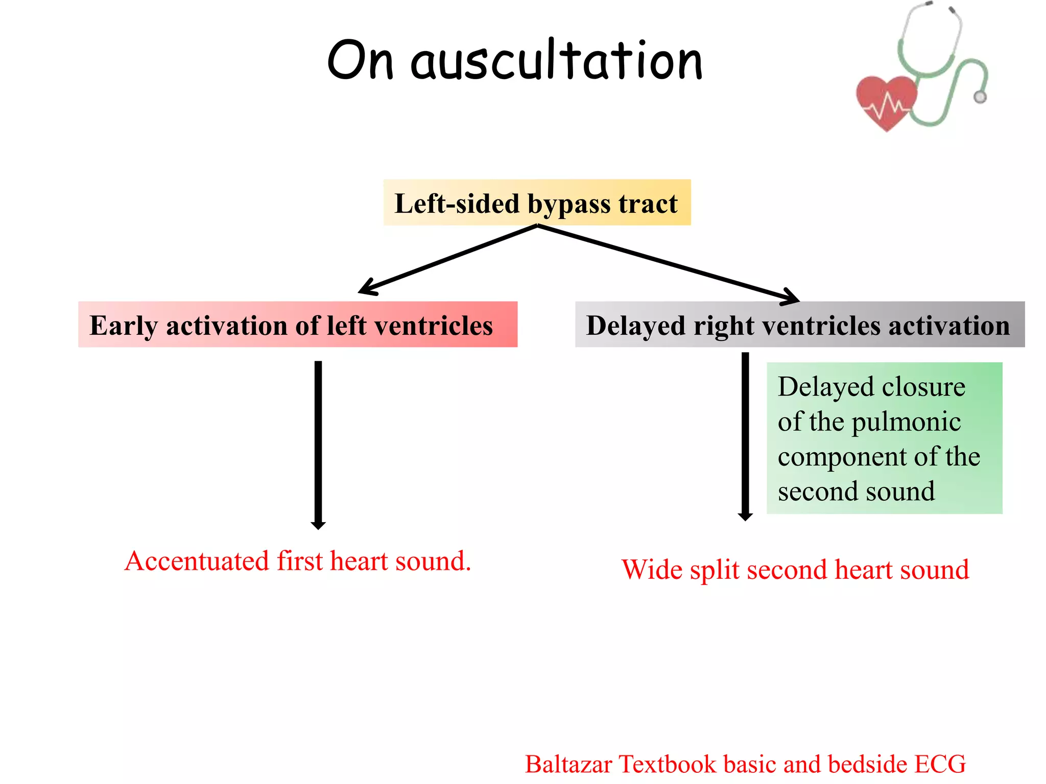 ECG localization of accessory pathways slideshare | PPTX