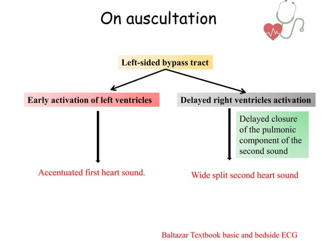 ECG localization of accessory pathways slideshare | PPTX