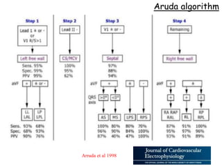 ECG localization of accessory pathways slideshare | PPT