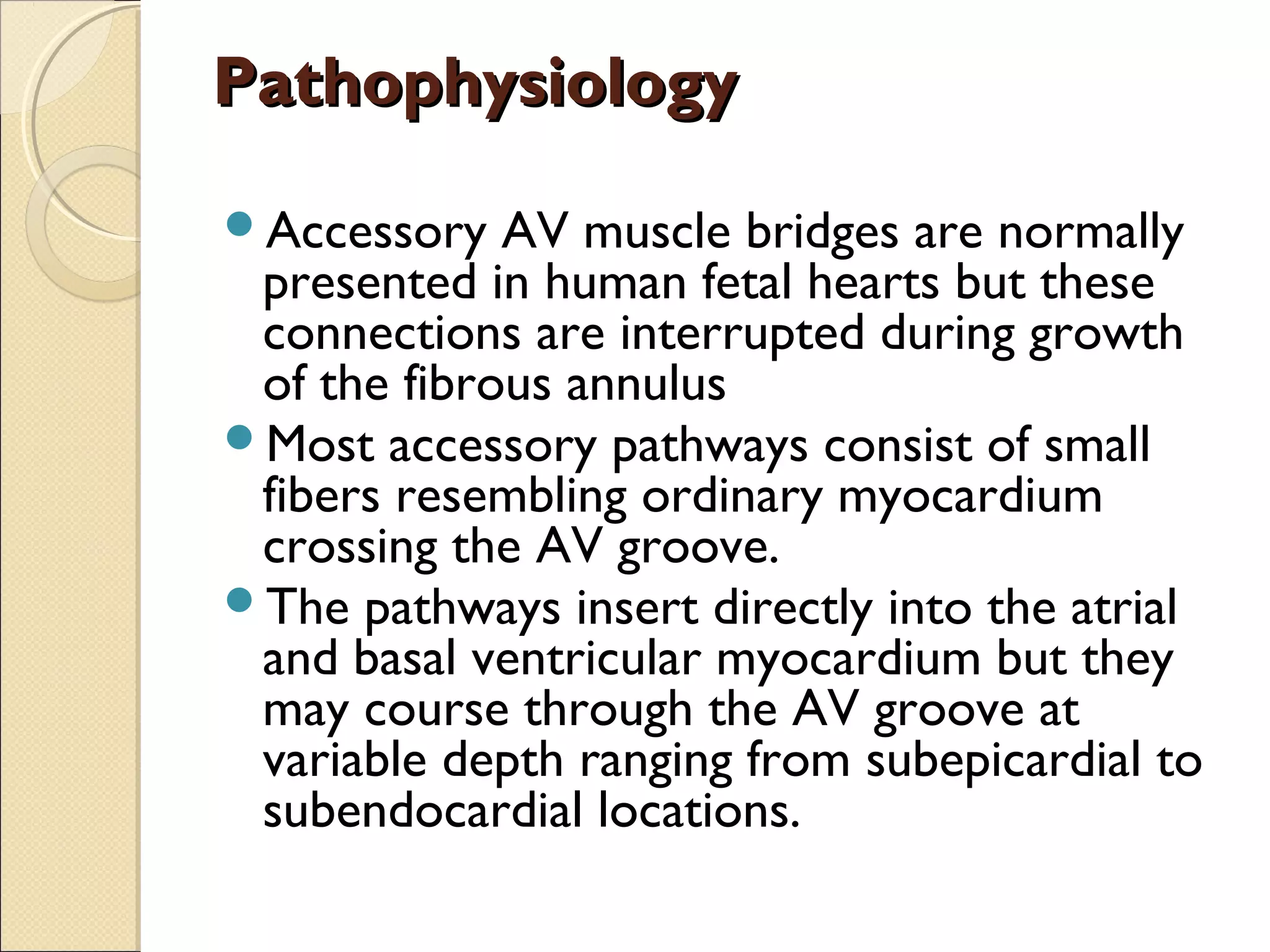 Wpw syndrome | PPT