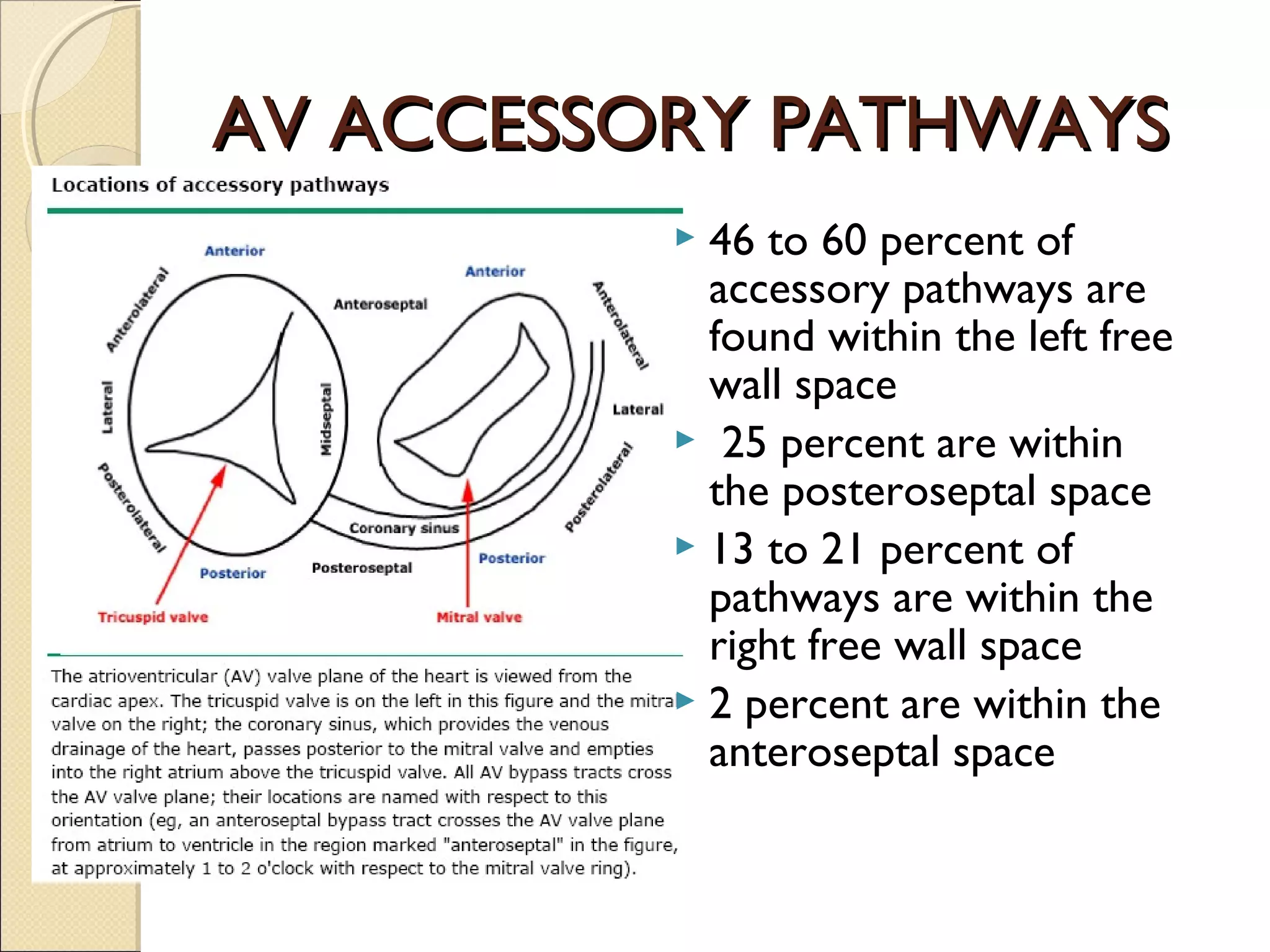 Wpw syndrome | PPT | Heart and Cardiovascular Diseases | Diseases and ...