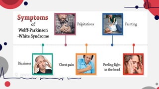 WPW SYNDROME pROJECT.pptx
