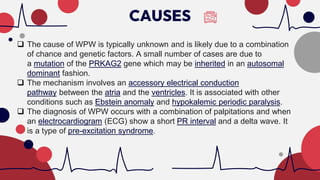WPW SYNDROME pROJECT.pptx
