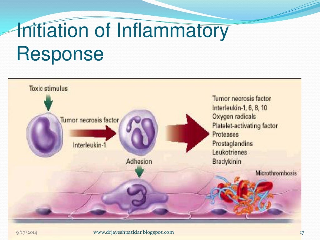Multi organ dysfunction syndrome