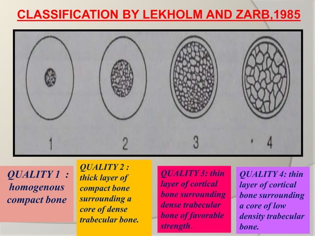 Bone : Basics | PPTX