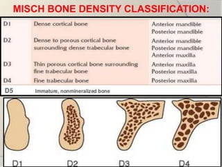 Bone : Basics | PPT