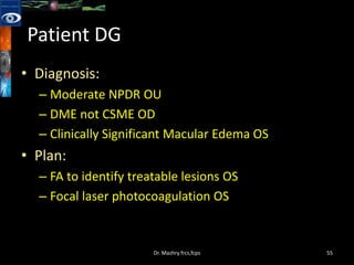Diabetic macular edema-Current treatment Modalities | PPTX