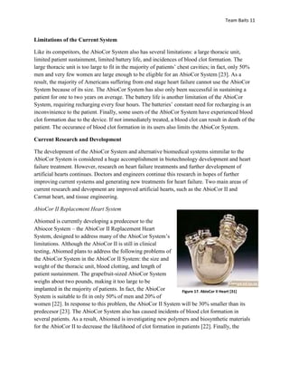 AbioCor Heart System | PDF