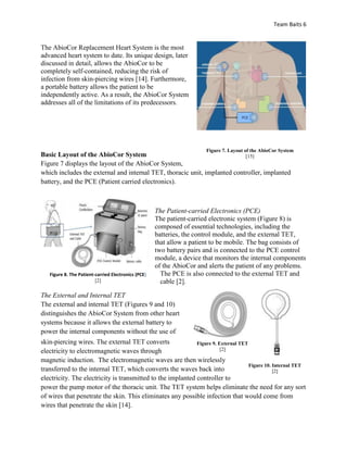 AbioCor Heart System | PDF