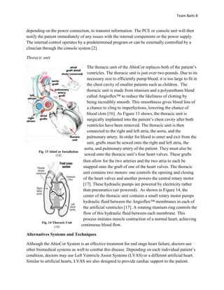 AbioCor Heart System | PDF