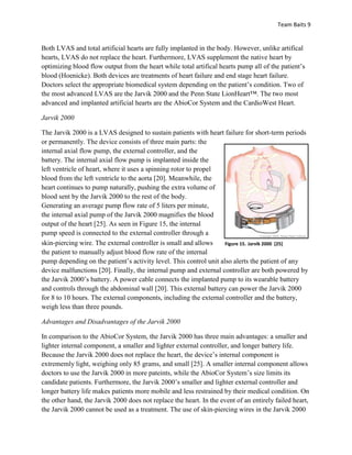 AbioCor Heart System | PDF