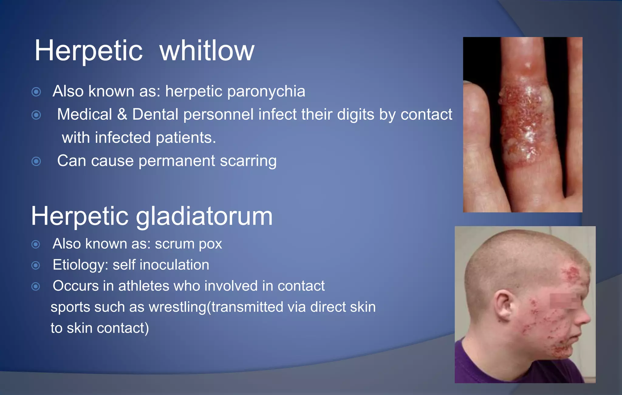 COMMON_VIRAL_INFECTIONS_IN_CHILDREN_AND_ORAL_MANIFESTATIONS.pptx
