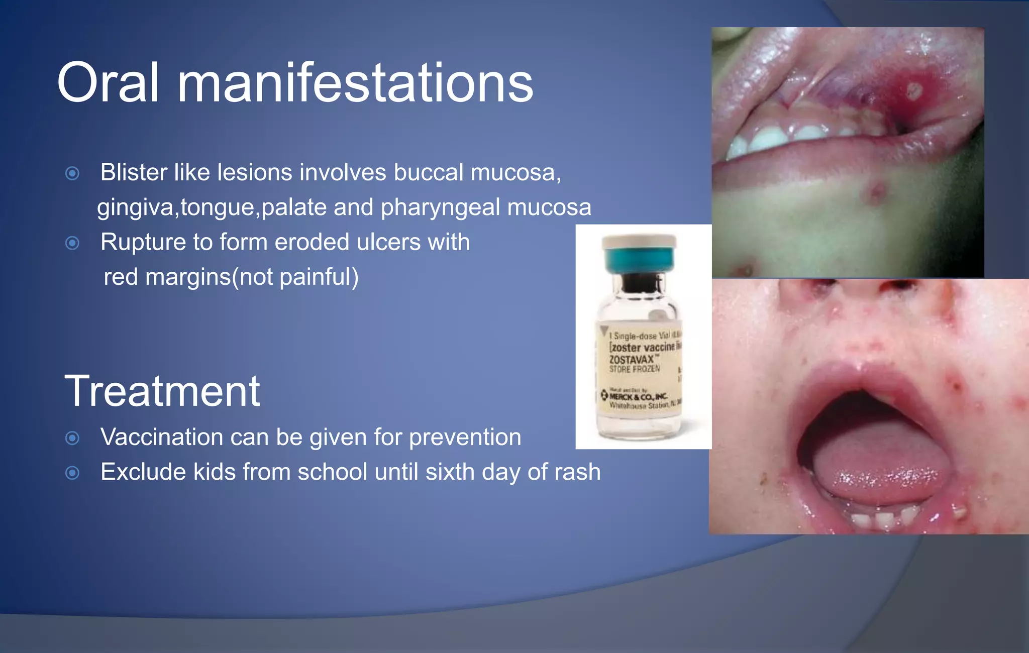 COMMON_VIRAL_INFECTIONS_IN_CHILDREN_AND_ORAL_MANIFESTATIONS.pptx