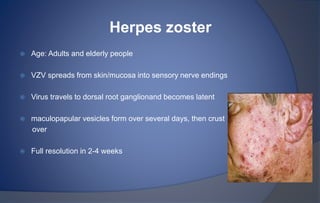 COMMON_VIRAL_INFECTIONS_IN_CHILDREN_AND_ORAL_MANIFESTATIONS.pptx