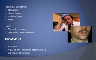 COMMON_VIRAL_INFECTIONS_IN_CHILDREN_AND_ORAL_MANIFESTATIONS.pptx