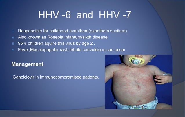 COMMON_VIRAL_INFECTIONS_IN_CHILDREN_AND_ORAL_MANIFESTATIONS.pptx
