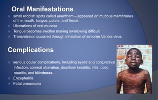 COMMON_VIRAL_INFECTIONS_IN_CHILDREN_AND_ORAL_MANIFESTATIONS.pptx