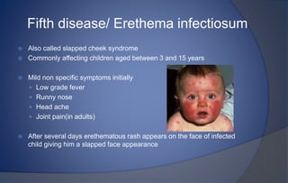 COMMON_VIRAL_INFECTIONS_IN_CHILDREN_AND_ORAL_MANIFESTATIONS.pptx