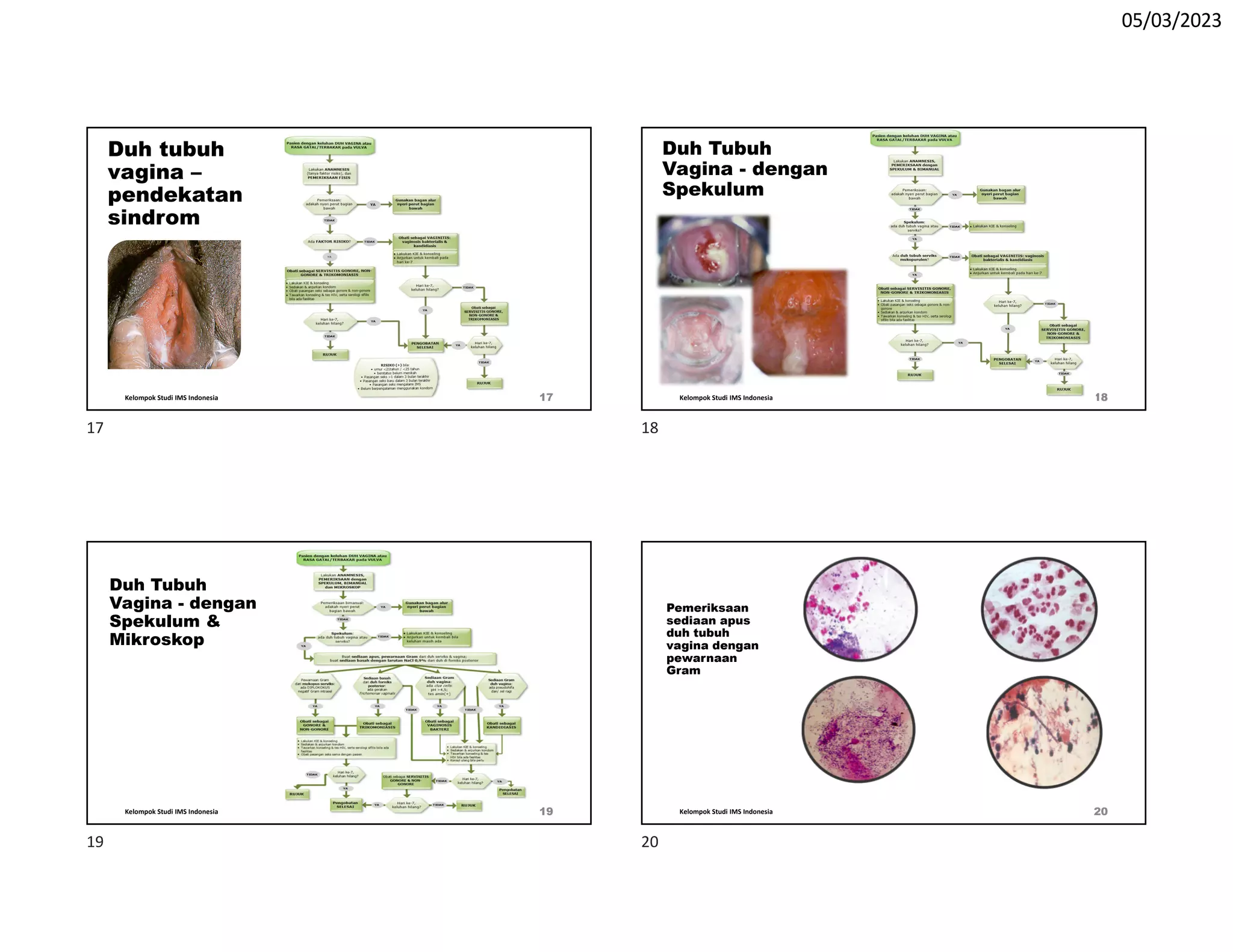 Wresti_Tata laksana IMS bdsrk Sindrom&Etiologi_kirim.pdf