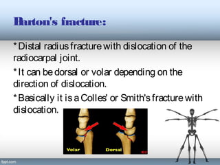 Wrist | PPT