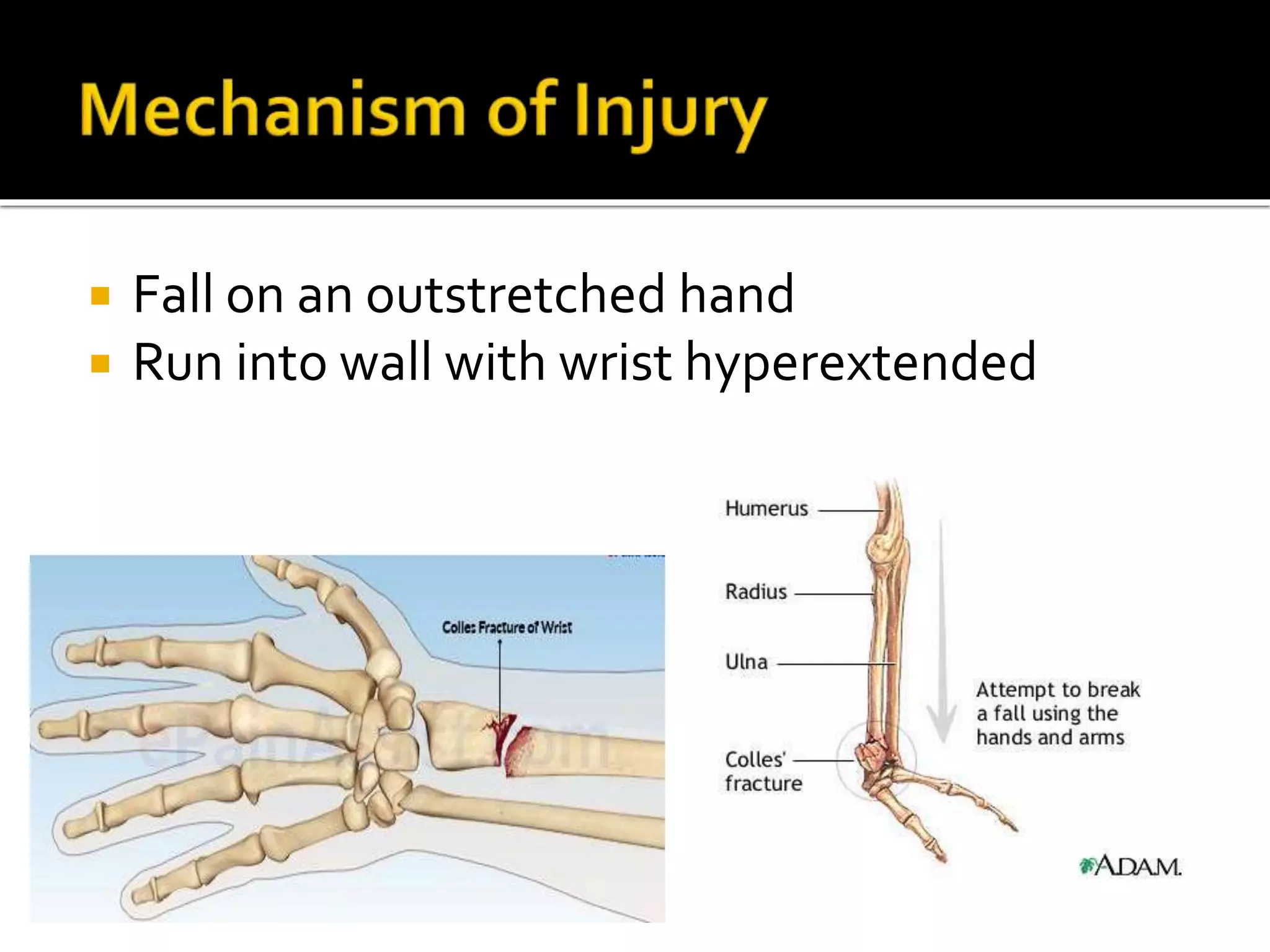 elbow and wrist and hand fracture with management | PPTX