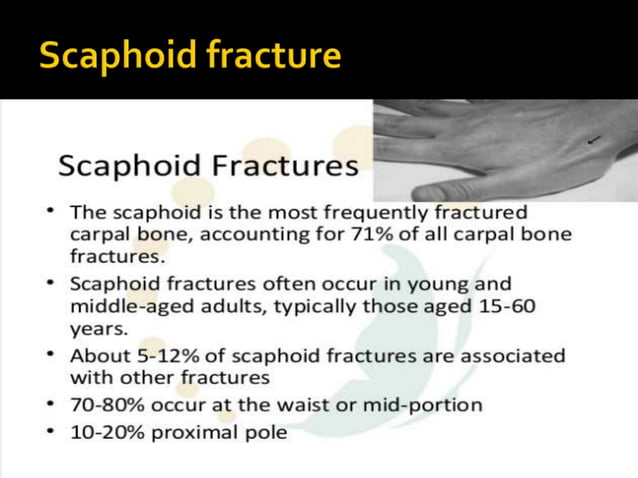 elbow and wrist and hand fracture with management | PPTX | Death ...