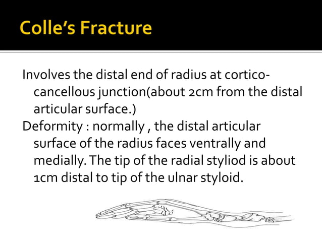 elbow and wrist and hand fracture with management | PPTX | Death ...