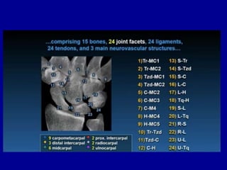 Chronic Wrist Pain And Examination | PPTX