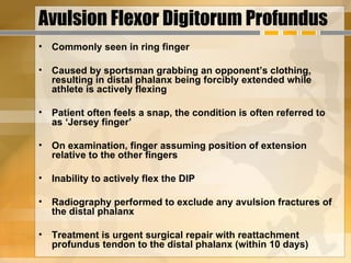 hand injuries in sports | PPT